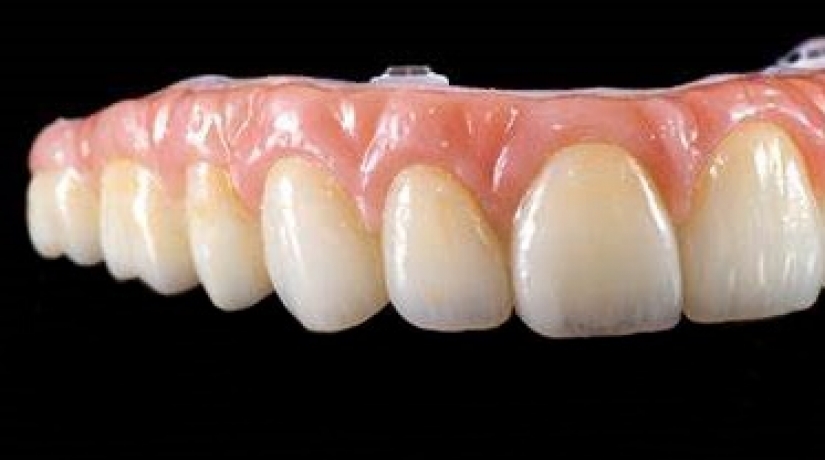 Especialização em Prótese Fixa